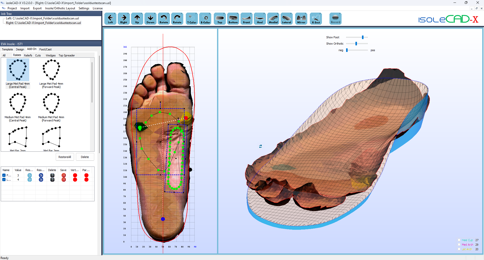 isoleCAD-X — 3D Foot Scanners, Foot Pressure Plate, Insole Design/Shoe ...