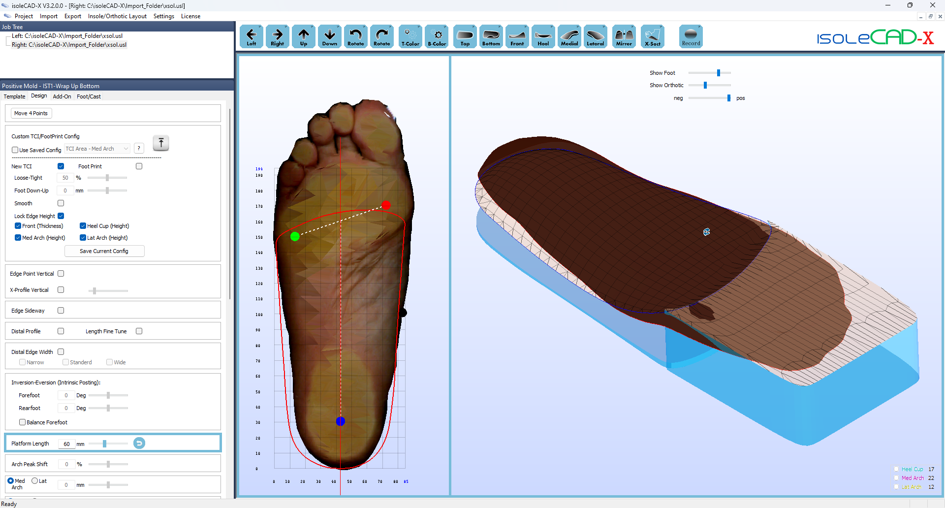 isoleCAD-X — 3D Foot Scanners, Foot Pressure Plate, Insole Design/Shoe ...