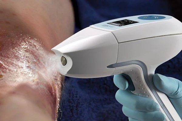 UltraMIST Therapy — Paradigm Wound Specialists
