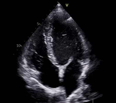Echocardiography Lessons — The Echo Journal