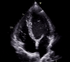 Echocardiography Lessons — The Echo Journal