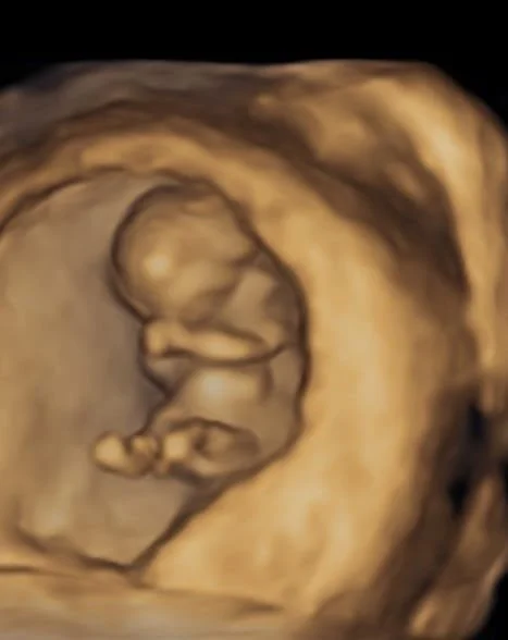 Pregnancy Ultrasounds and Extras — Peek A Boo 3D 4D Ultrasound