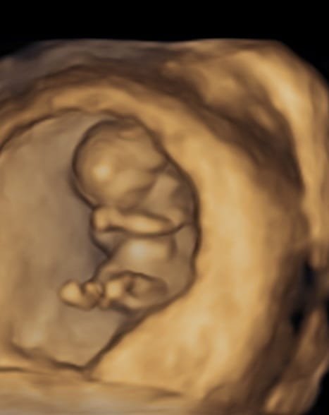 Pregnancy Ultrasounds and Extras — Peek A Boo 3D 4D Ultrasound
