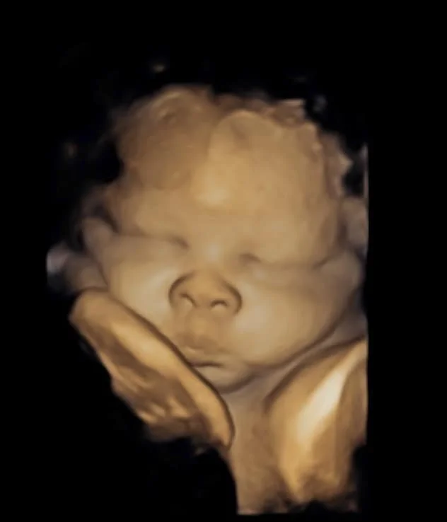 Pregnancy Ultrasounds and Extras — Peek A Boo 3D 4D Ultrasound