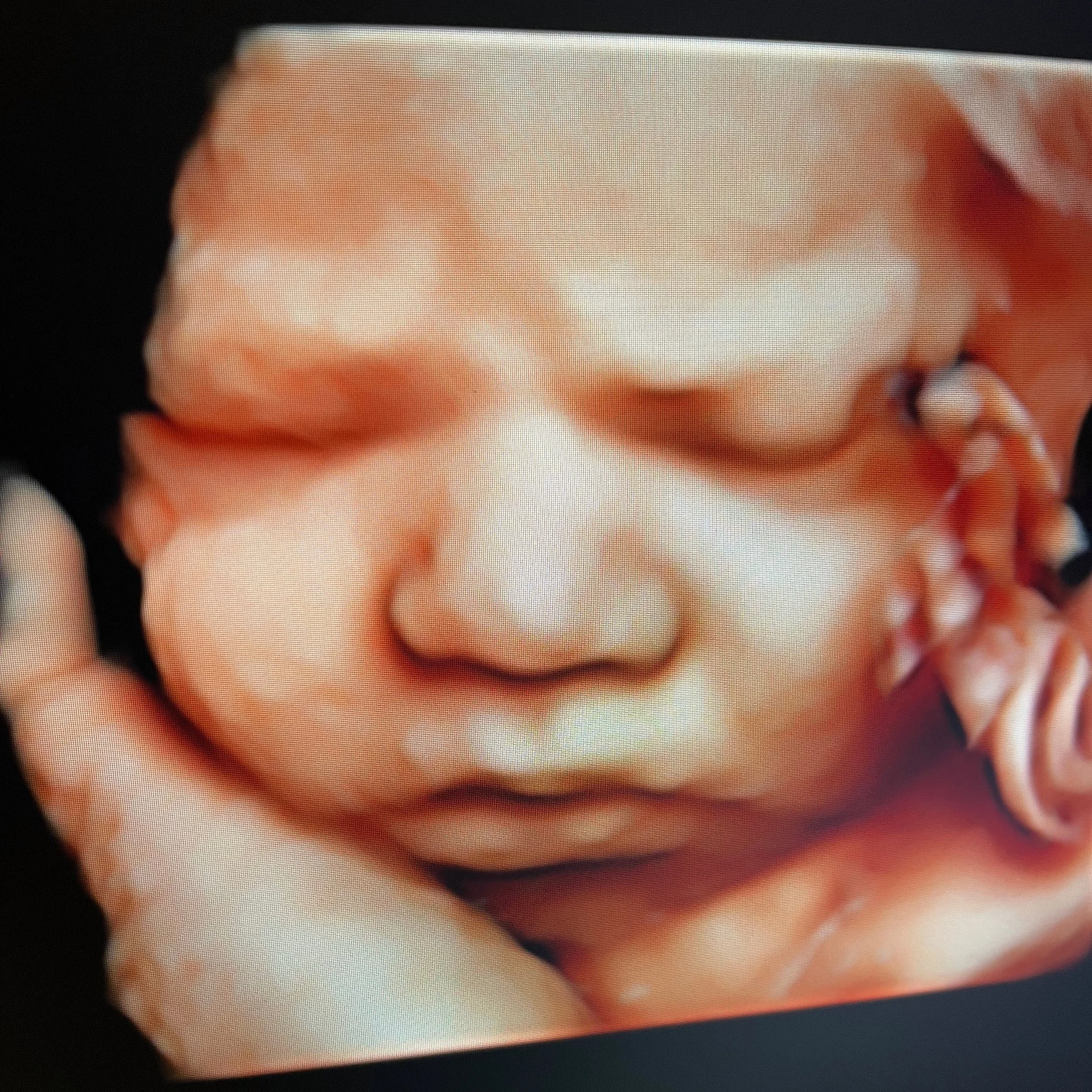 A Peek Inside Mobile Ultrasound - 3D/4D Mobile Ultrasounds in Memphis, TN