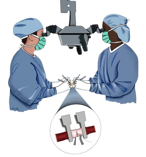 What is Microsurgery — American Society for Reconstructive Microsurgery