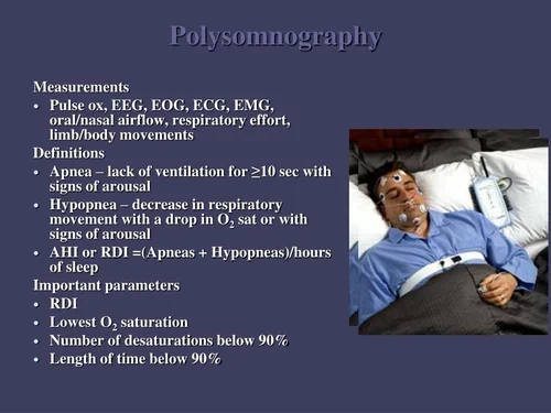 Polysomnography — SC Sleep Medicine