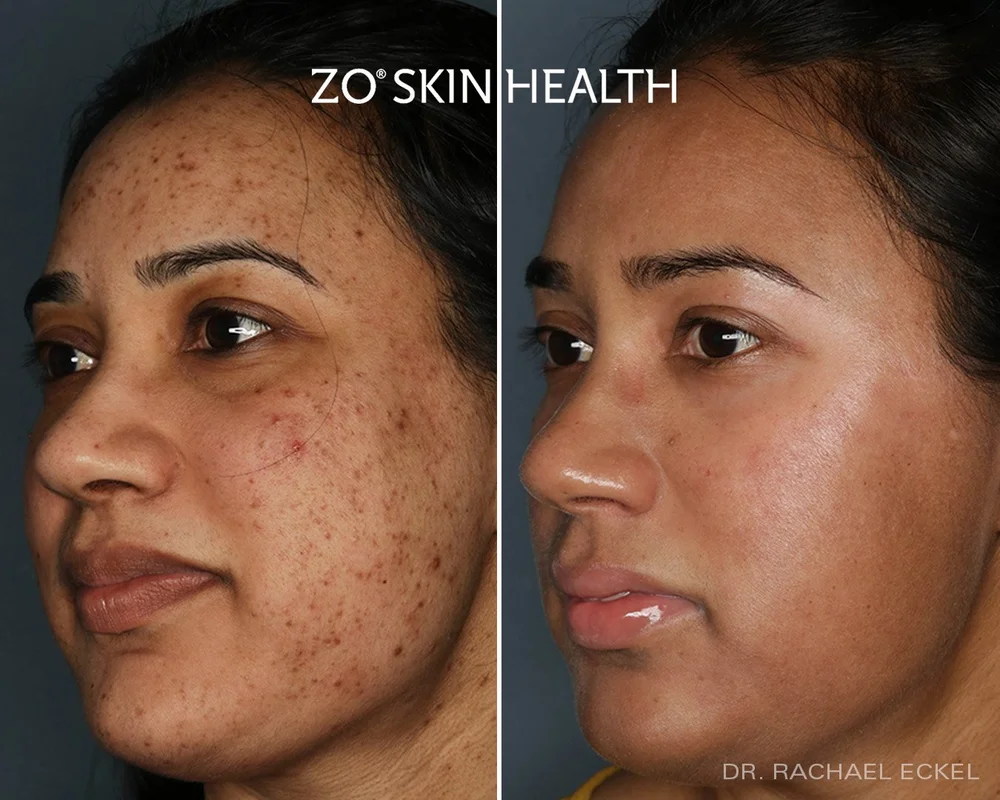 ZO® Skin Health — Dermedica Medical