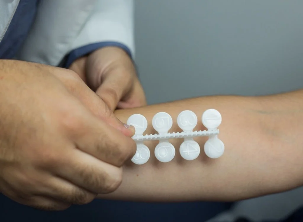 Allergy Skin Test — AZ Allergy