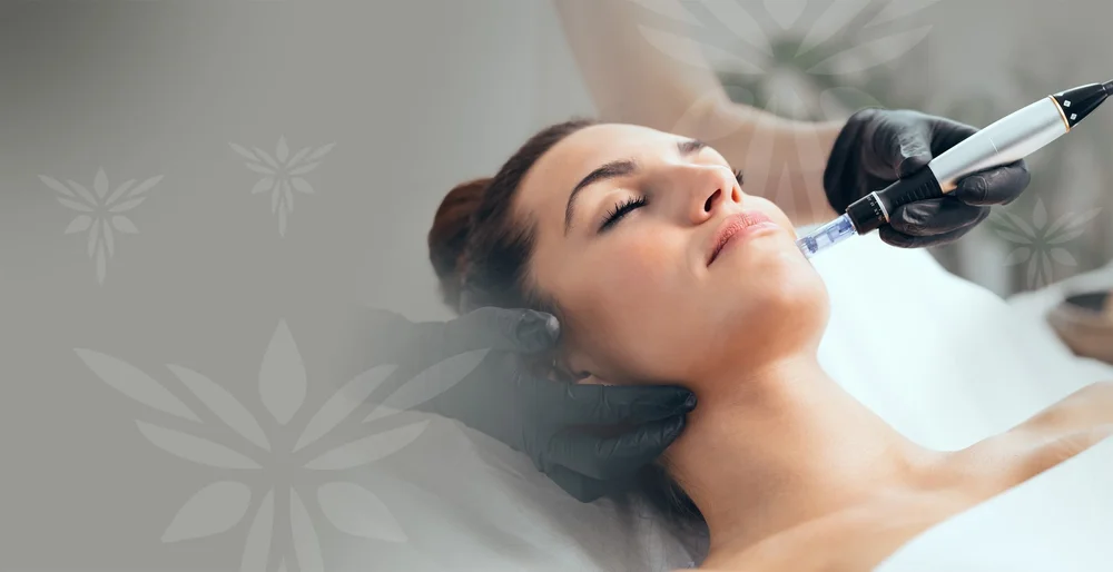Microneedling Near Me Gulfport & Biloxi | Smoother Skin Awaits ...