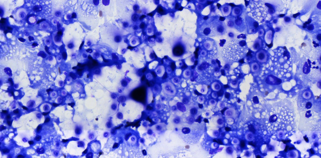 Pathview — Moichor