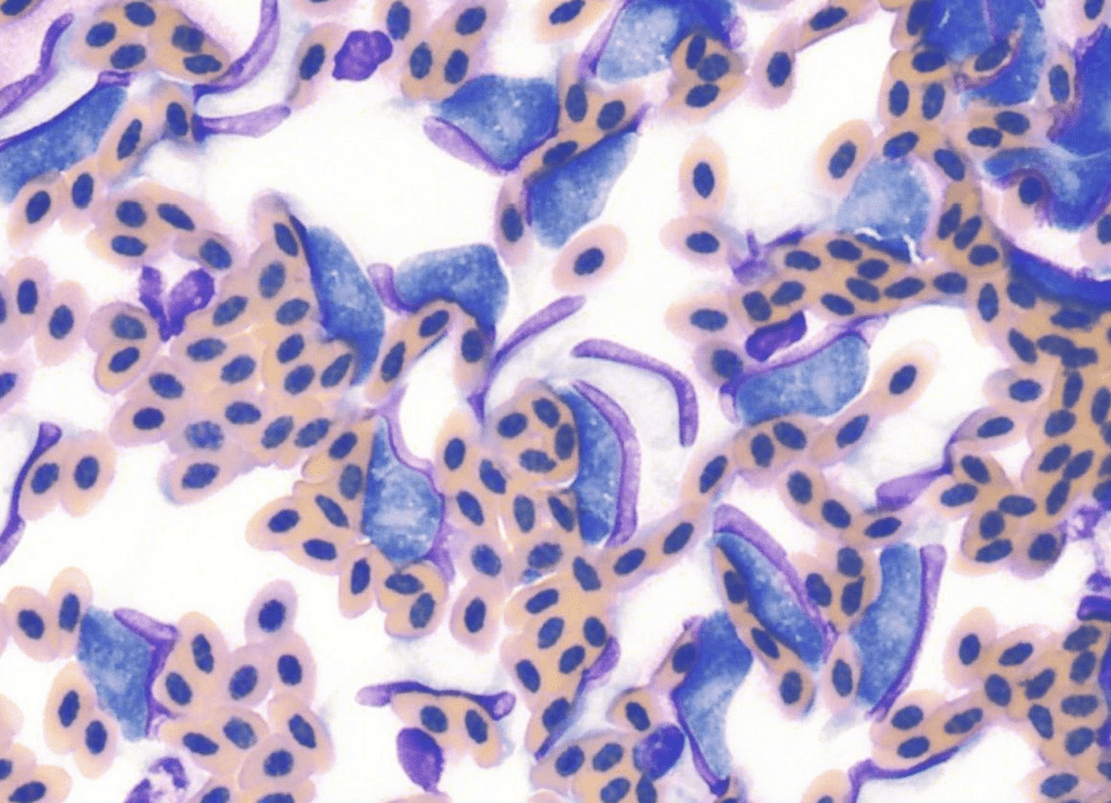 Pathview — Moichor