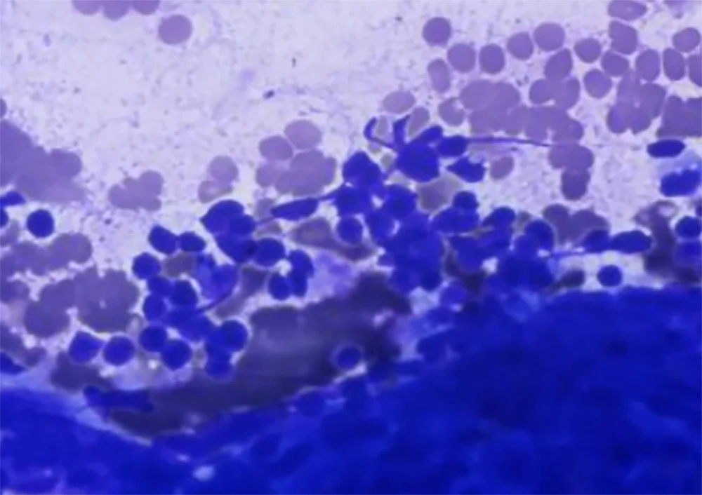 Mastering Fine-Needle Aspiration in Veterinary Medicine: Best Practices ...