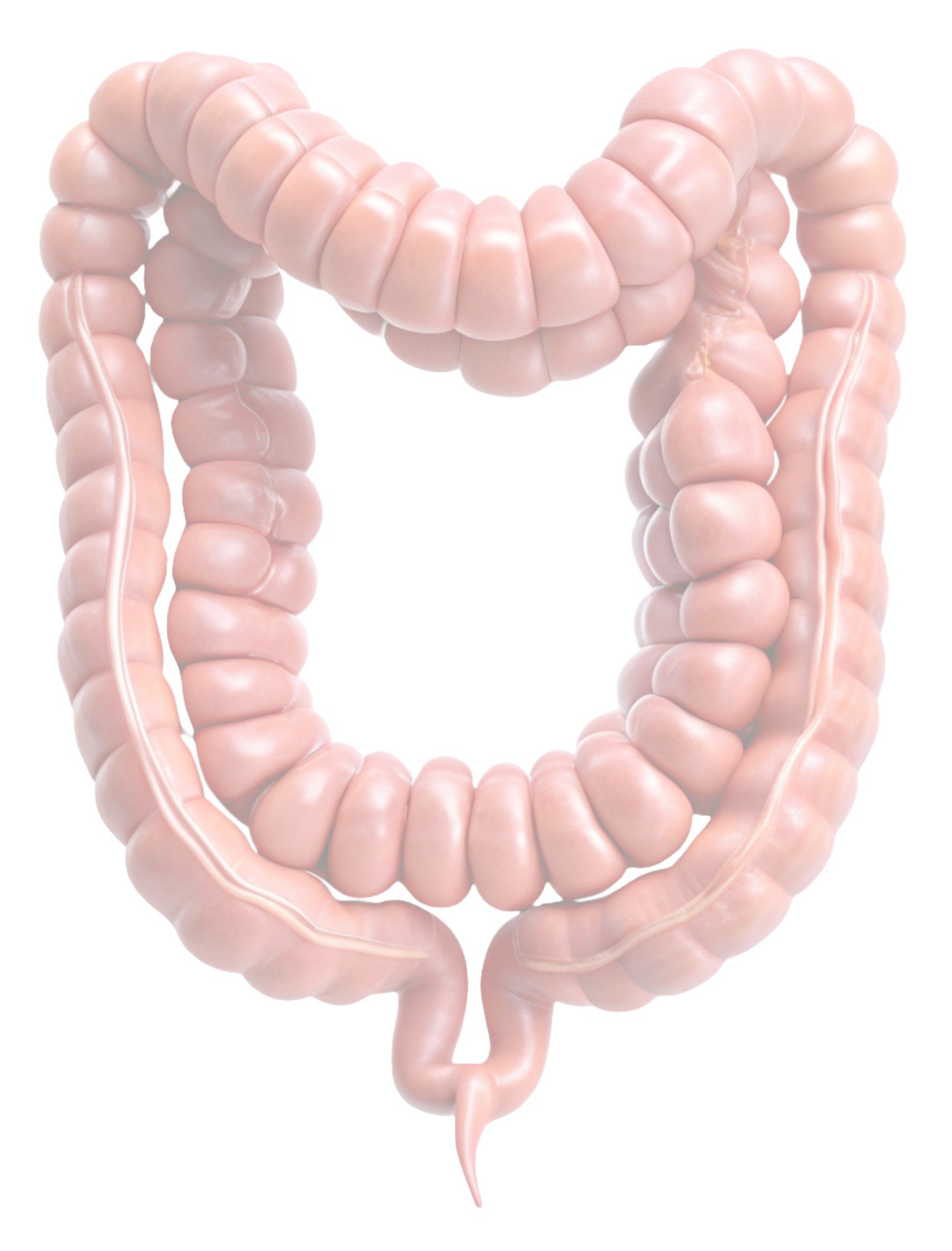 Appendix Endometriosis — The Center for Endometriosis Care