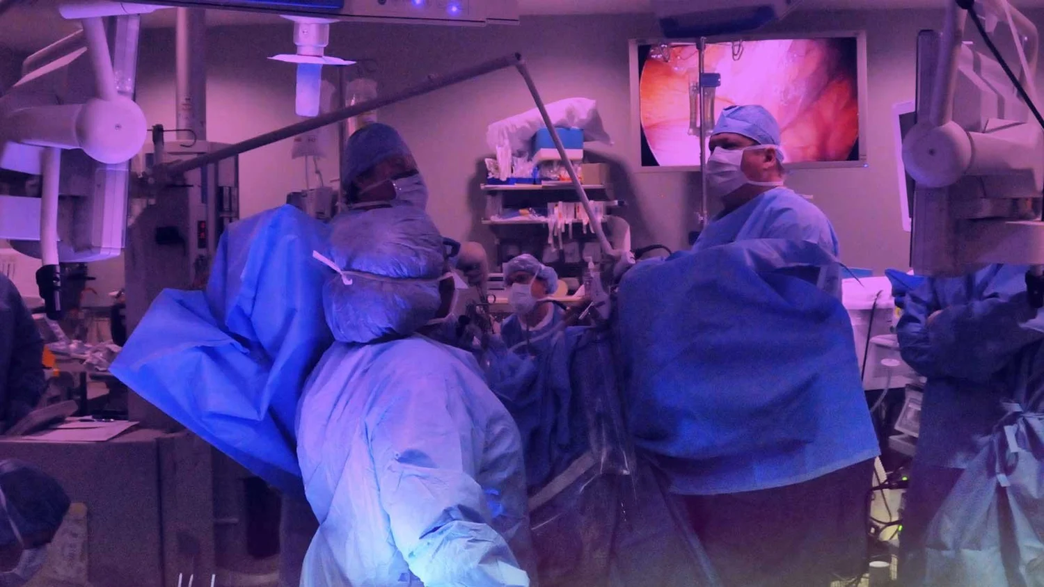 About Excision (LAPEX) — The Center for Endometriosis Care