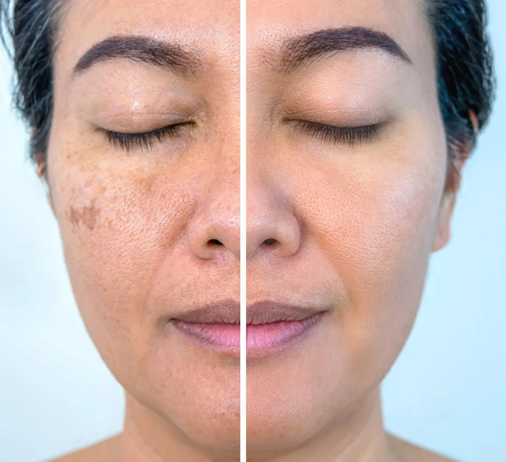 Sun Damage Restoration | Reverse Sun Damage Now — The Skin Company