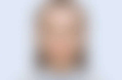 Why eye color varies — Eye Health Center