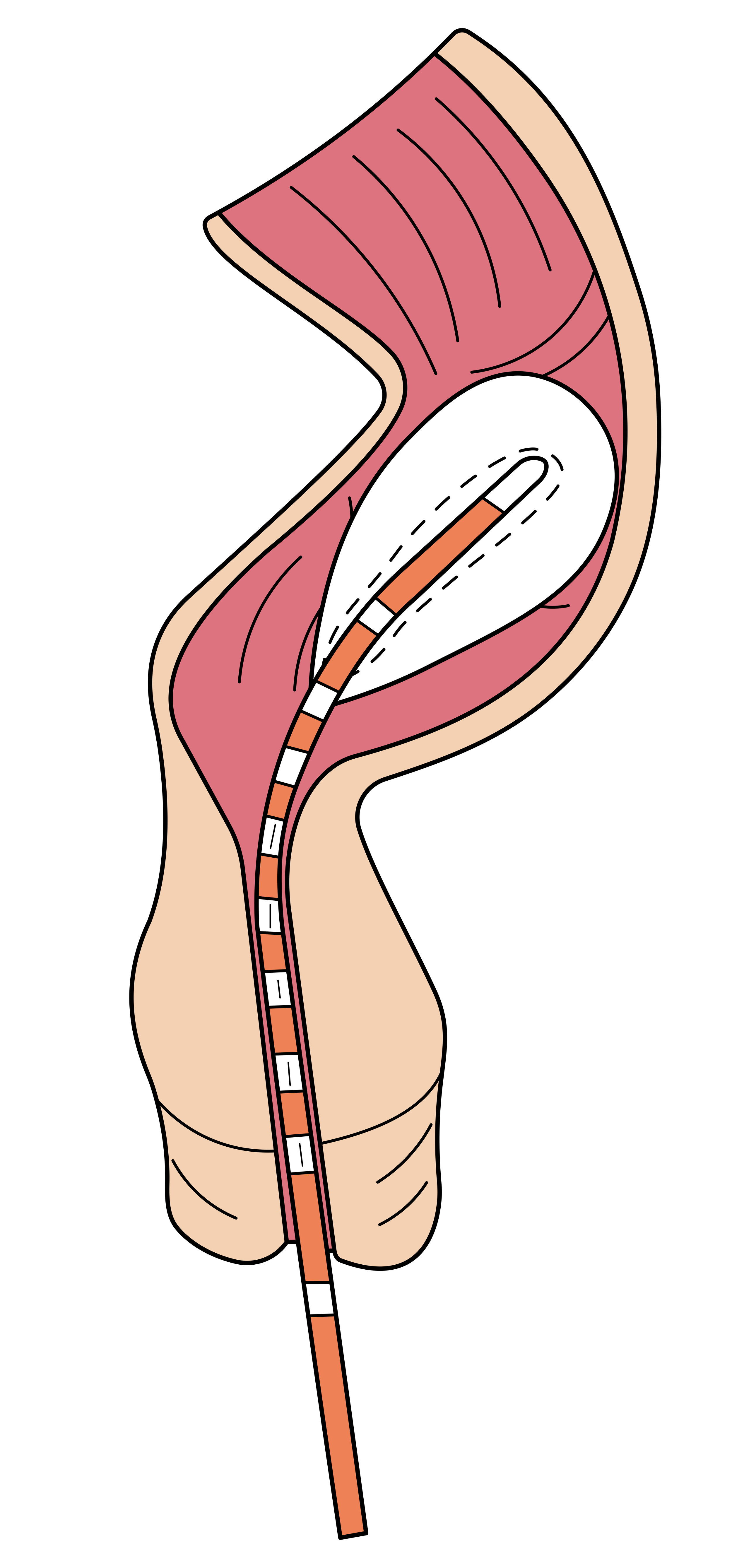Anorectal Manometry Victoria — Bowel Health Scan | Melbourne Victoria