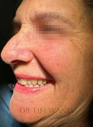 Before and After — Dr Tim Wang