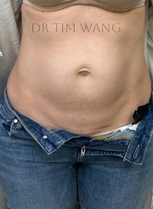 Before and After — Dr Tim Wang