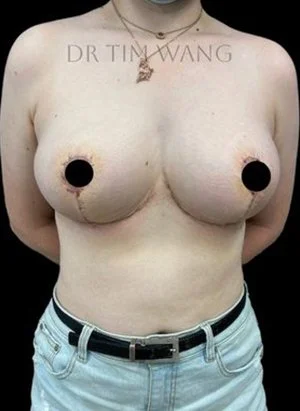 BeforeandAfter (Copy) — Dr Tim Wang