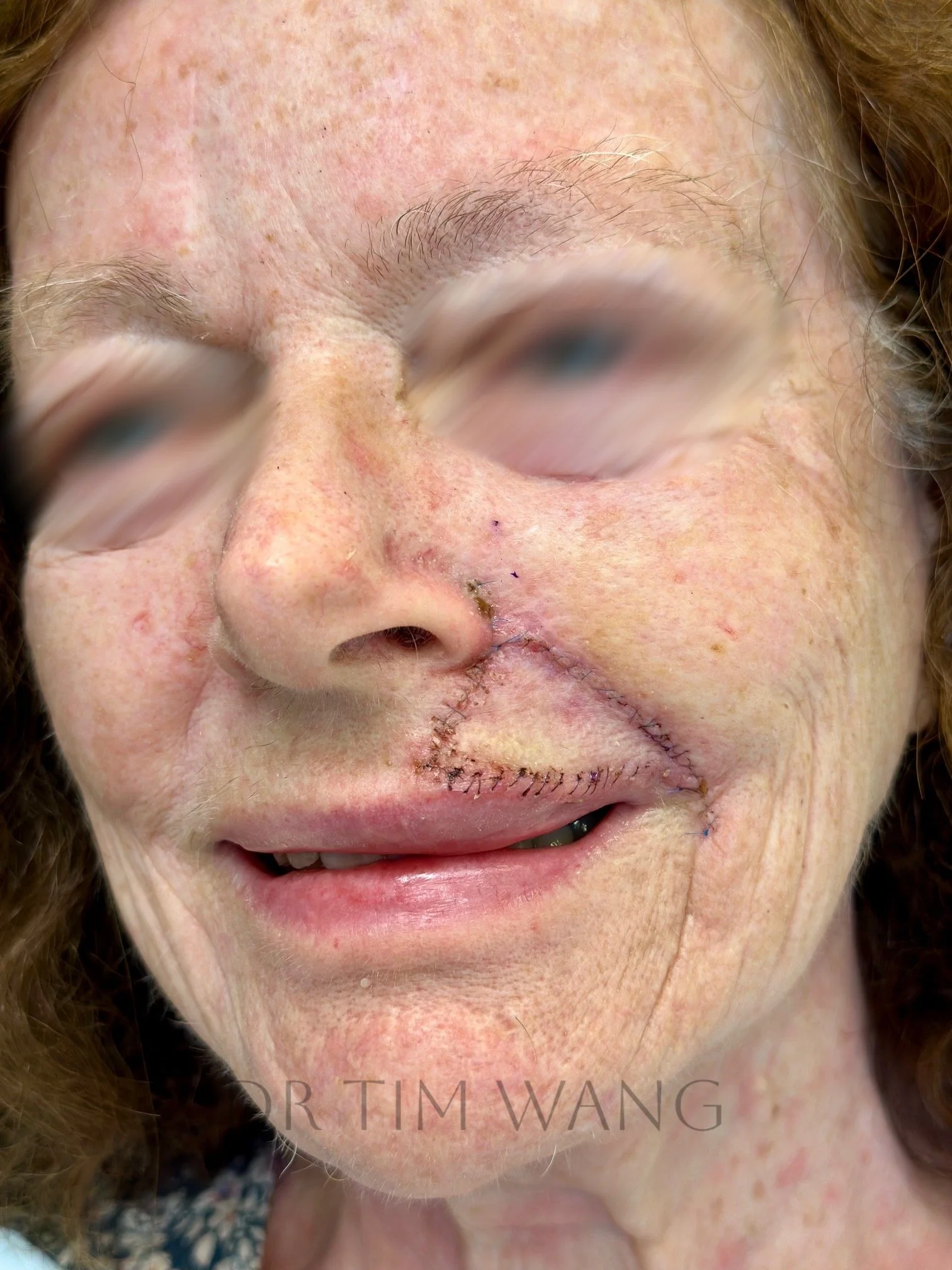 BeforeandAfter (Copy) — Dr Tim Wang