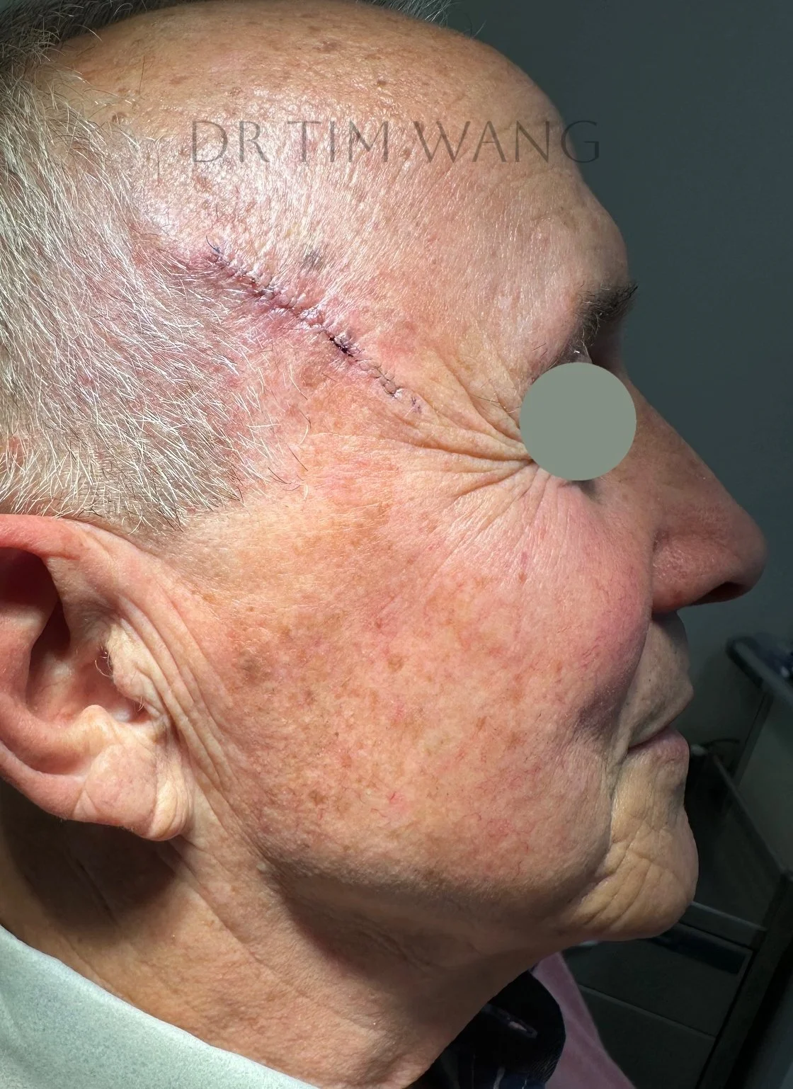 Before and After — Dr Tim Wang