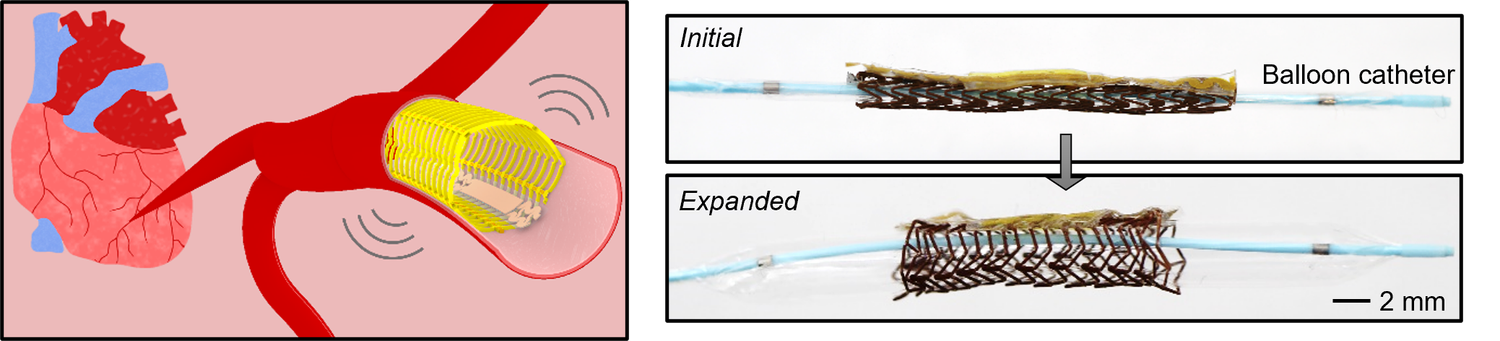 Research — Herbert Lab