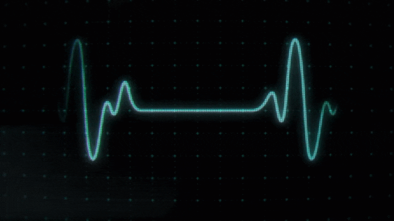 Tools — Cardiovascular Data Science Lab (CarDS) Lab @ Yale