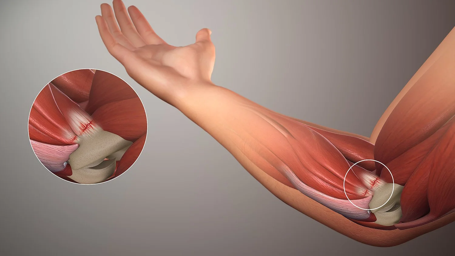3 Common Injuries for Guitarists — Dexterity Hand Therapy
