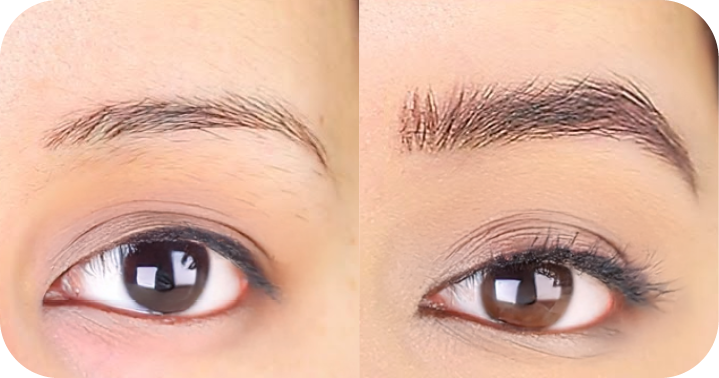 Sparse Brows? Regrow Them Naturally with Microneedling — La Dermalogique