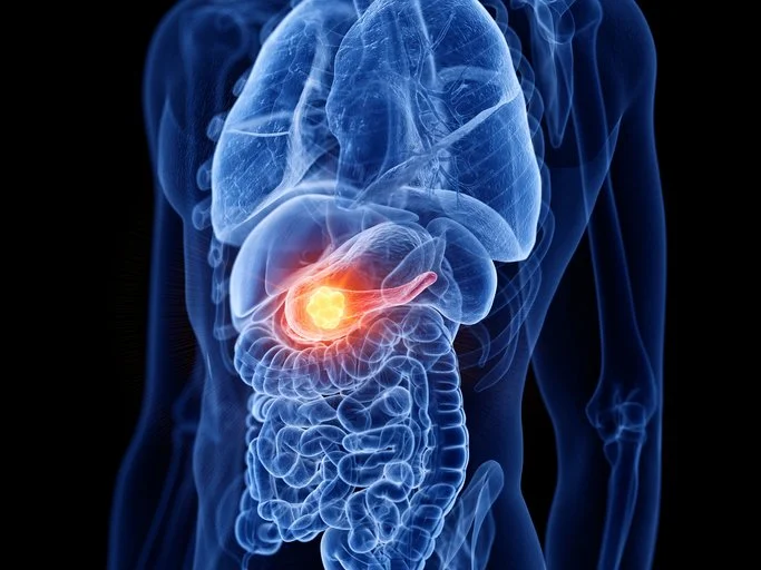 Why Is Pancreatic Cancer So Deadly? The Science Is Finally Changing ...