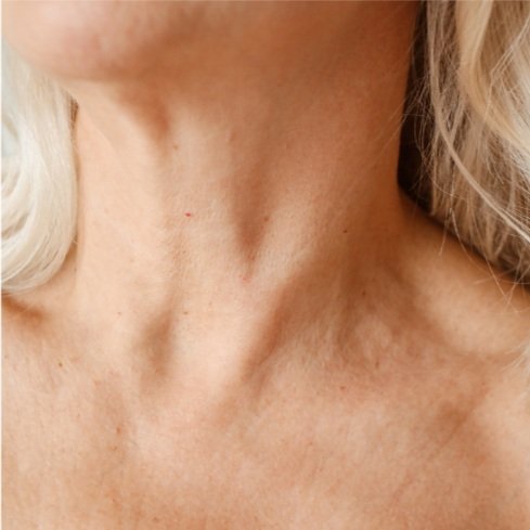 North Claremont Medspa | The Claremont Village Medical Spa | Boon ...