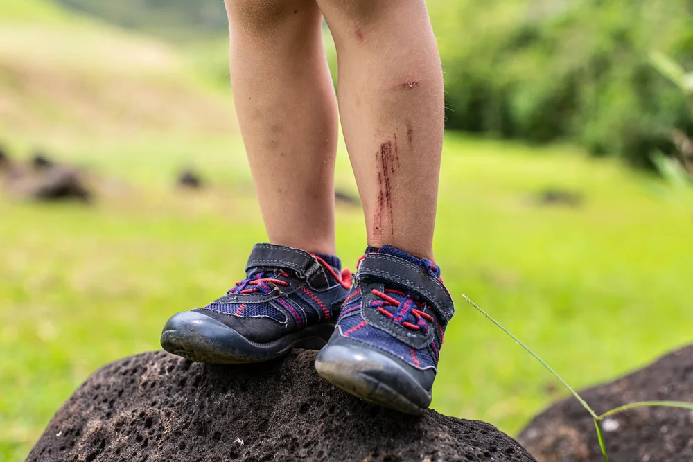 Minor Cuts, Scratches + Abrasions | Discover Gentle First Aid Tips ...