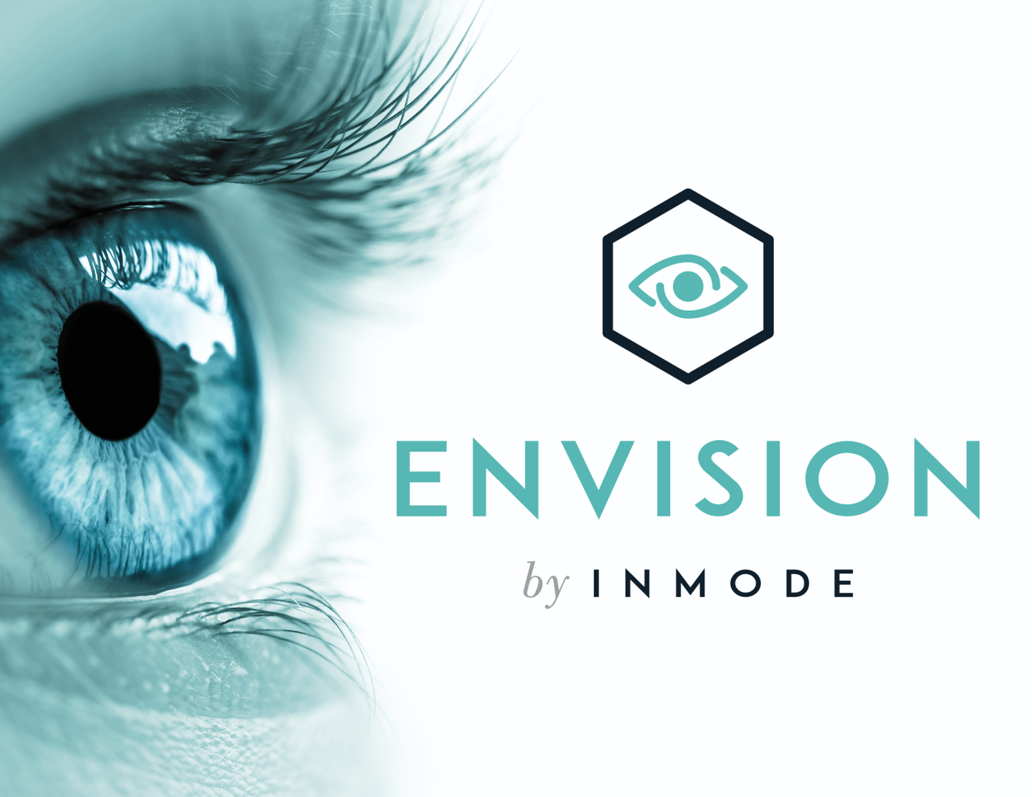 ENVISION BY INMODE — Visionary Eye Care