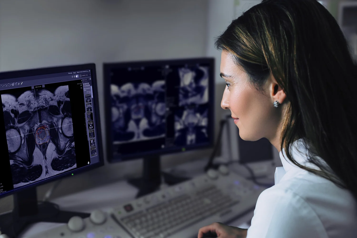 KI für die Radiologie - Mint Medical
