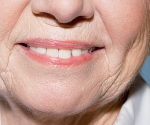 Sagging Skin Treatments in Toronto | Emerald Skin Lab