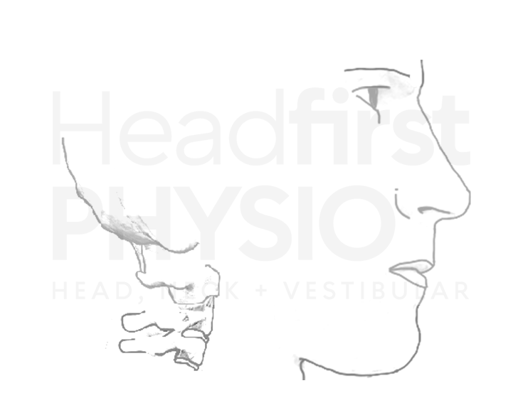 Physiotherapy for headache Bendigo — HeadFirst Physio