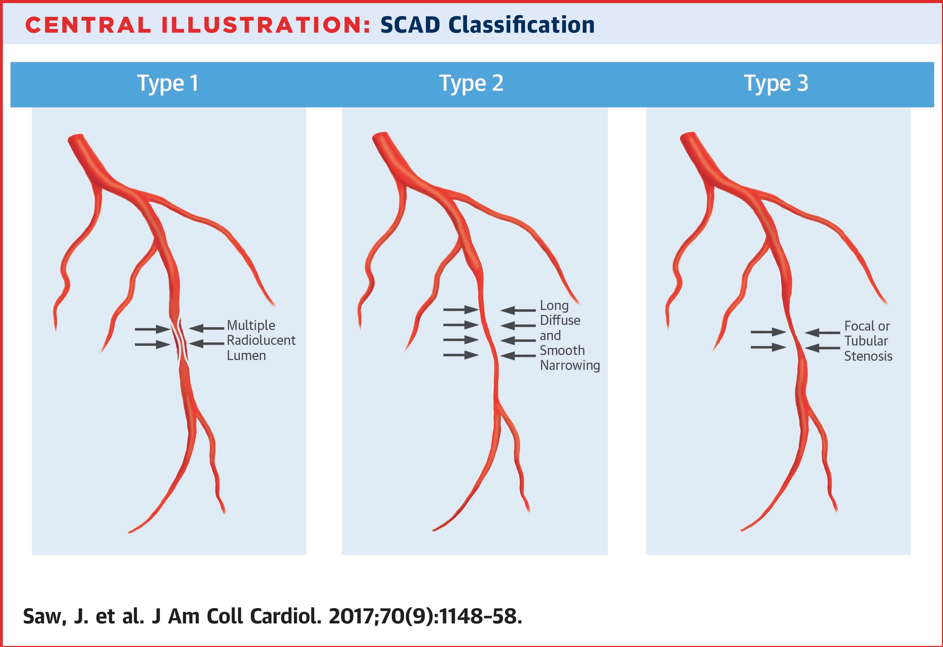 Wat is SCAD — SCAD Nederland