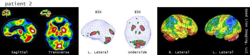 The Neuroscience Center