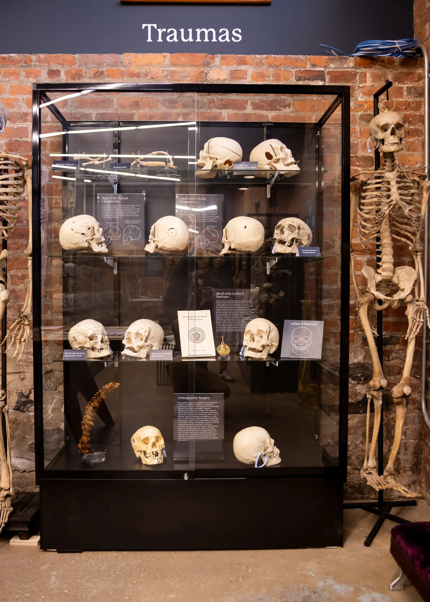 The Bone Museum