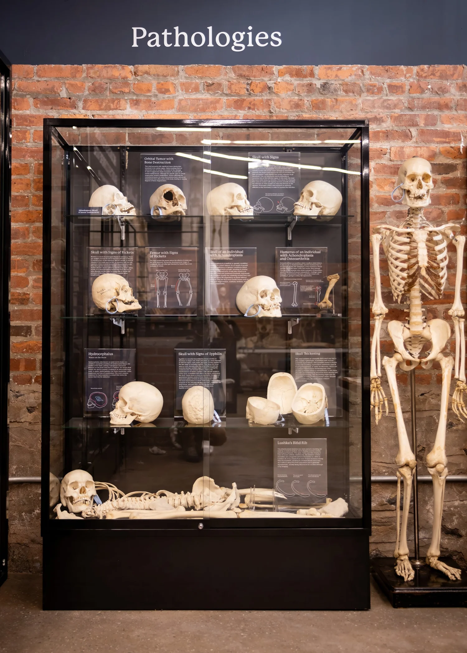 The Bone Museum