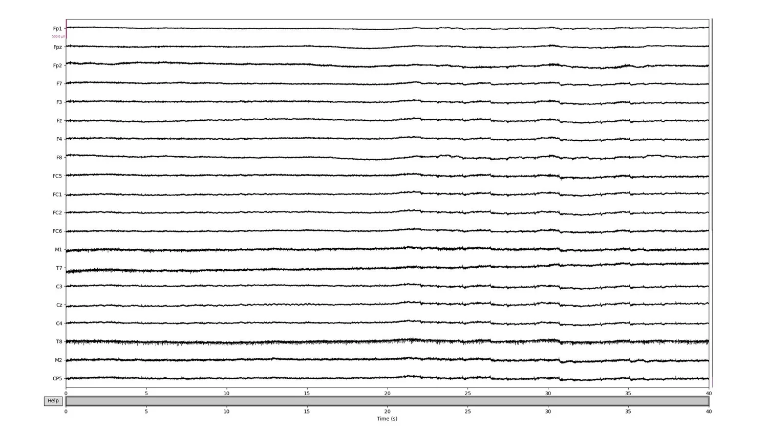 TMSi — an Artinis company — Removing Artifacts From EEG Data Using ...