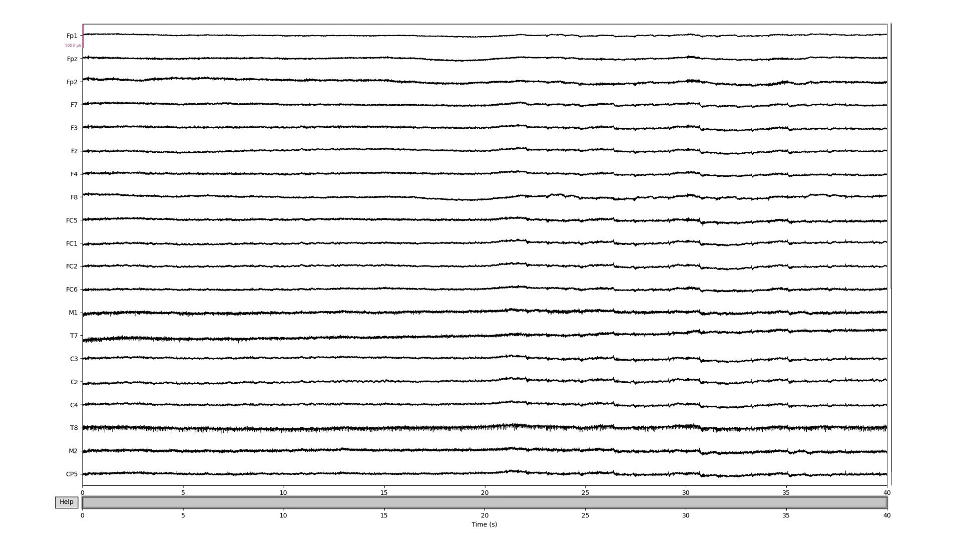 TMSi — an Artinis company — Removing Artifacts From EEG Data Using ...