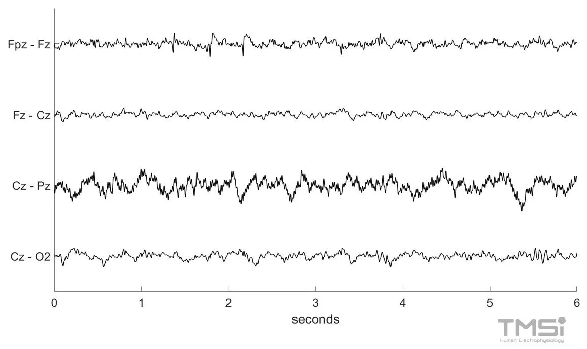 TMSi — an Artinis company — Common non-physiological (external) EEG ...