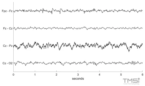 TMSi — an Artinis company — Common non-physiological (external) EEG ...
