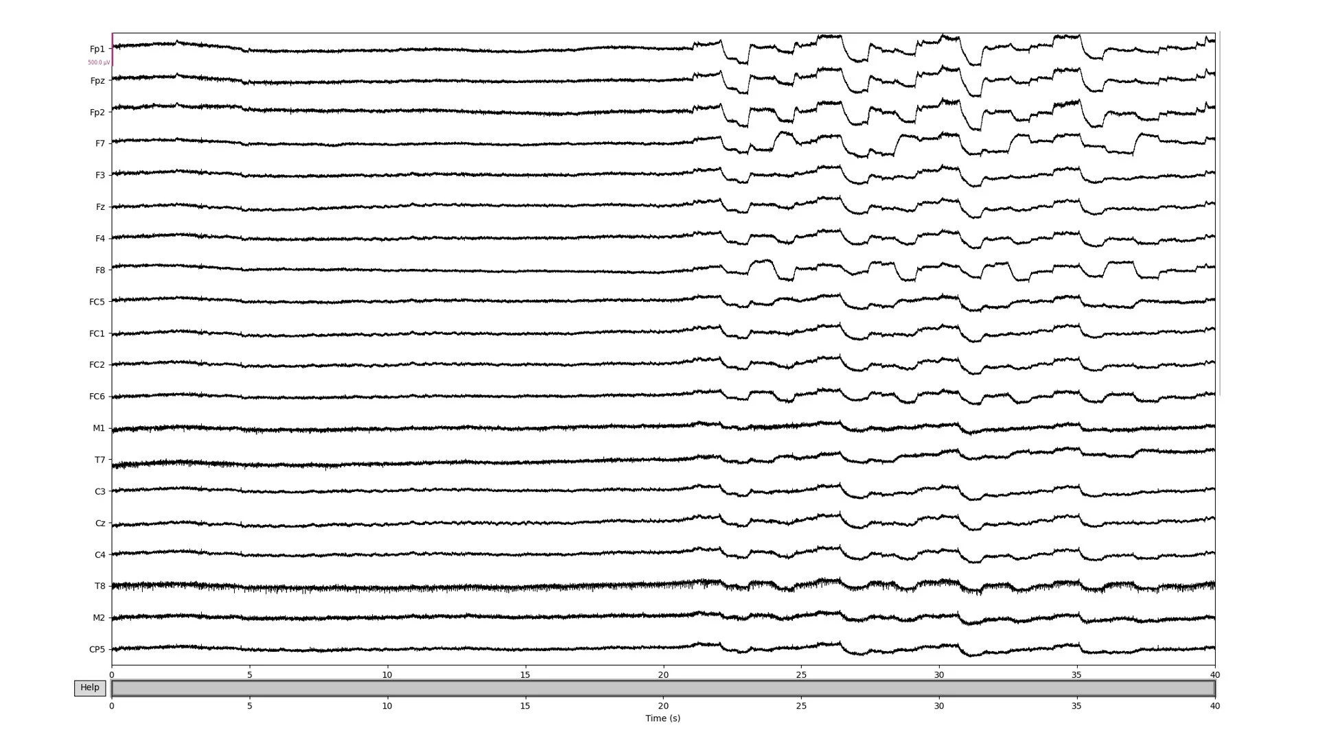 TMSi — an Artinis company — Removing Artifacts From EEG Data Using ...
