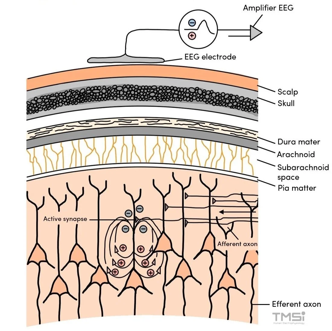 TMSi — an Artinis company — What is EEG