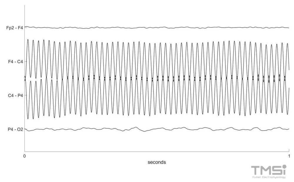 TMSi — an Artinis company — Common non-physiological (external) EEG ...