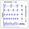 TMSi — an Artinis company — What Is Electromyography (EMG)?